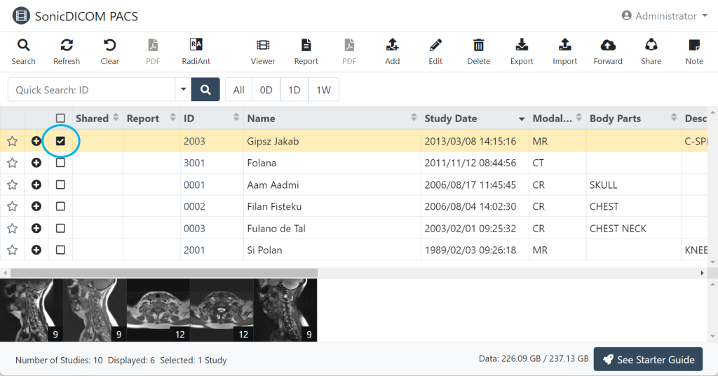 Integration with RadiAnt DICOM Viewer | SonicDICOM