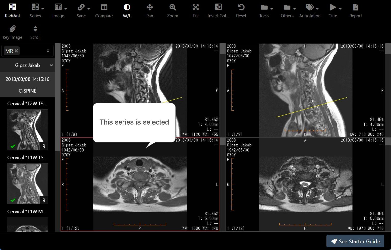 Integration with RadiAnt DICOM Viewer | SonicDICOM