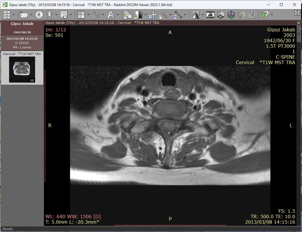 Integration with RadiAnt DICOM Viewer | SonicDICOM